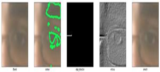 Research: Eye Tracking Analysis Using CNN
